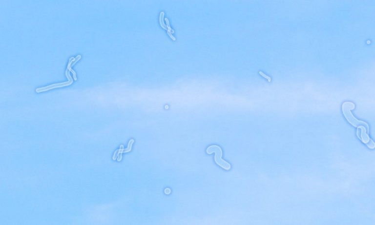 Manchas na visão podem indicar doenças graves; saiba como identificar ...